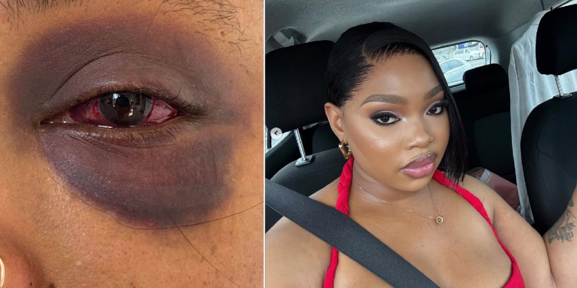 Sne Mthembu Accuses Boyfriend Andile Junior of Assault, Says Police ...